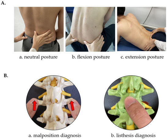 Comparison of Concordance between Chuna Manual Therapy Diagnostic ...