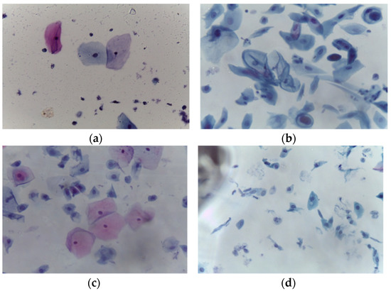 Analysis of Cytology Pap Smear Images Based on Ensemble Deep Learning ...