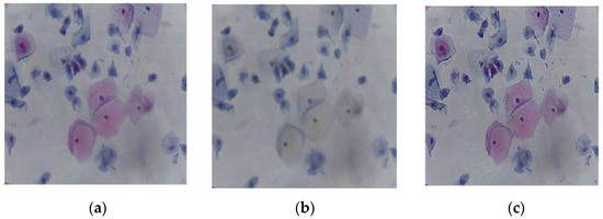 Analysis of Cytology Pap Smear Images Based on Ensemble Deep Learning ...