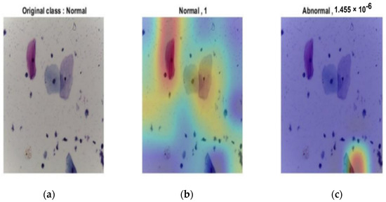Analysis of Cytology Pap Smear Images Based on Ensemble Deep Learning ...