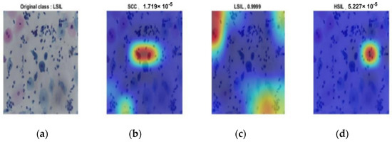 Analysis of Cytology Pap Smear Images Based on Ensemble Deep Learning ...