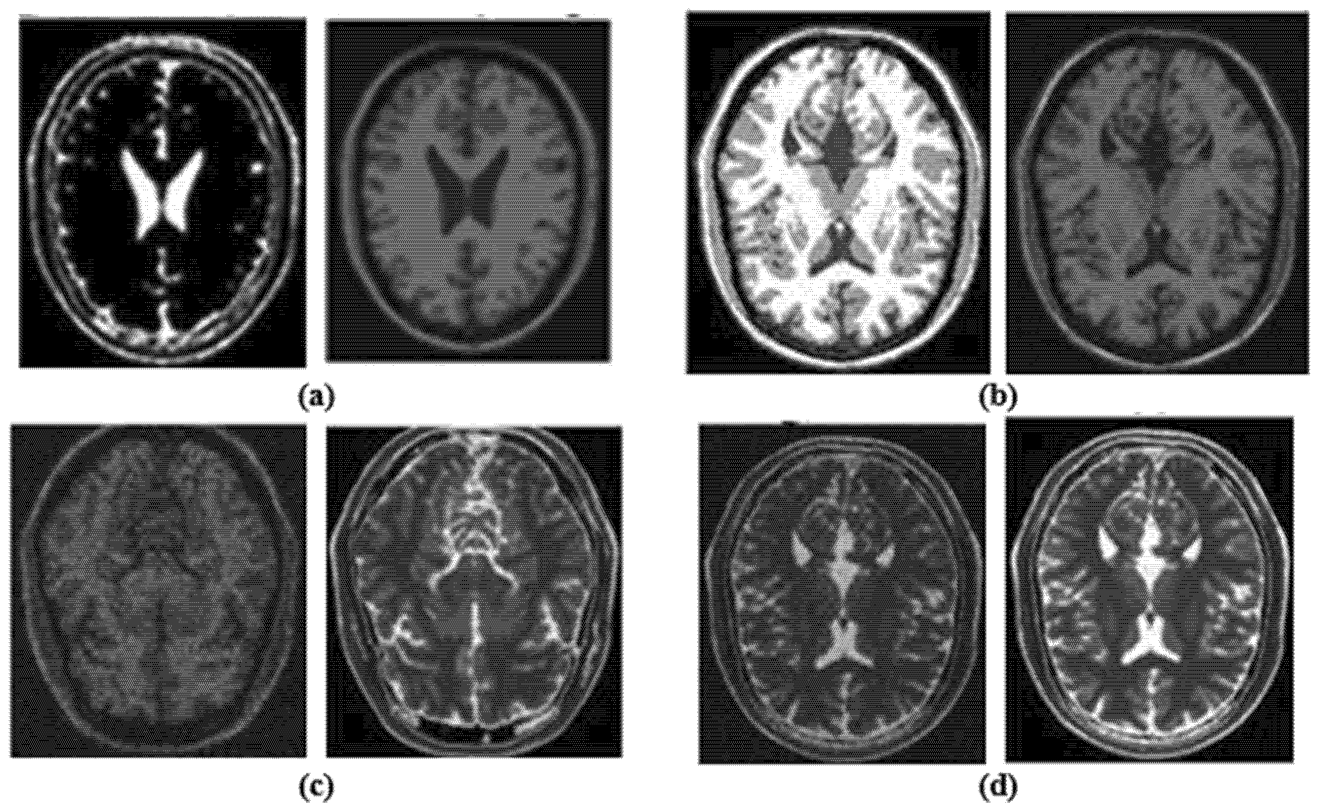 Diagnostics | Free Full-Text | An Enhanced Machine Learning Approach for Brain MRI Classification