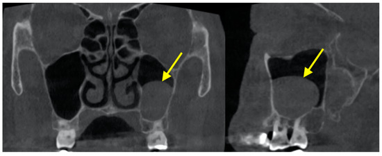 Diagnostics Free Full Text The Use Of Cbct In Evaluating The Health