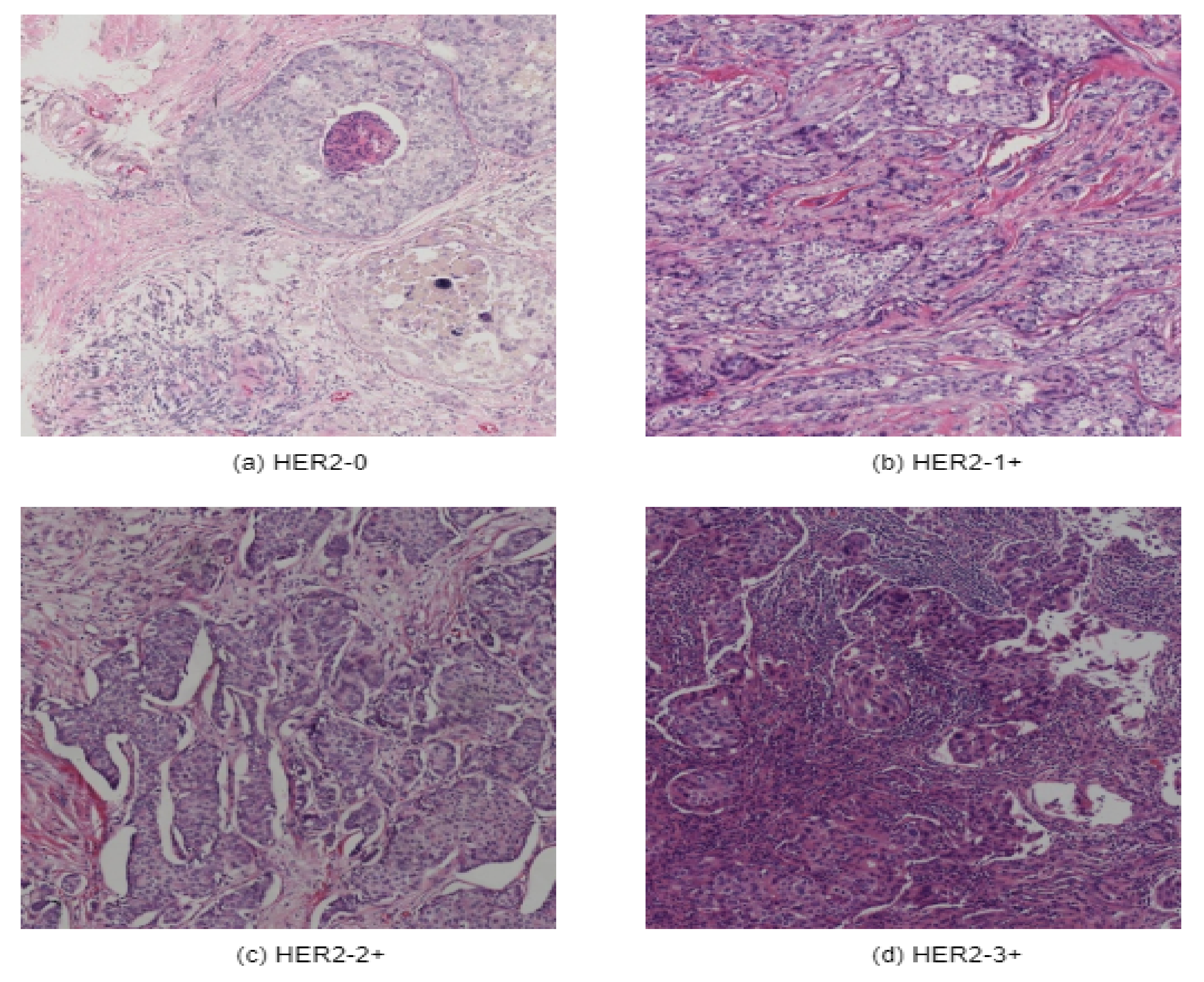 Diagnostics | Free Full-Text | Strategies for Enhancing the Multi-Stage Classification ...