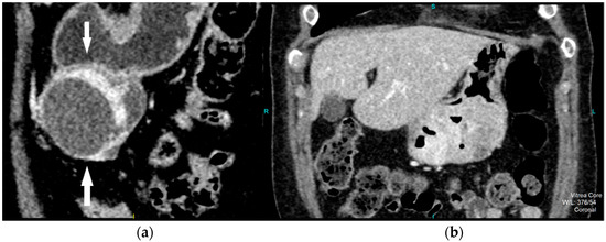 Diagnostics | Free Full-Text | The Utility of Conventional CT, CT ...