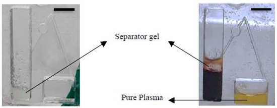 Extremely Precise Blood–Plasma Separation from Whole Blood on a ...