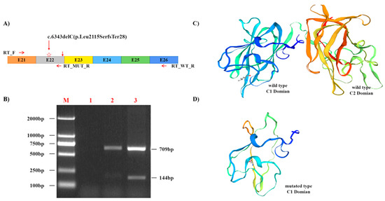 A Novel Deletion Mutation of the F8 Gene for Hemophilia A