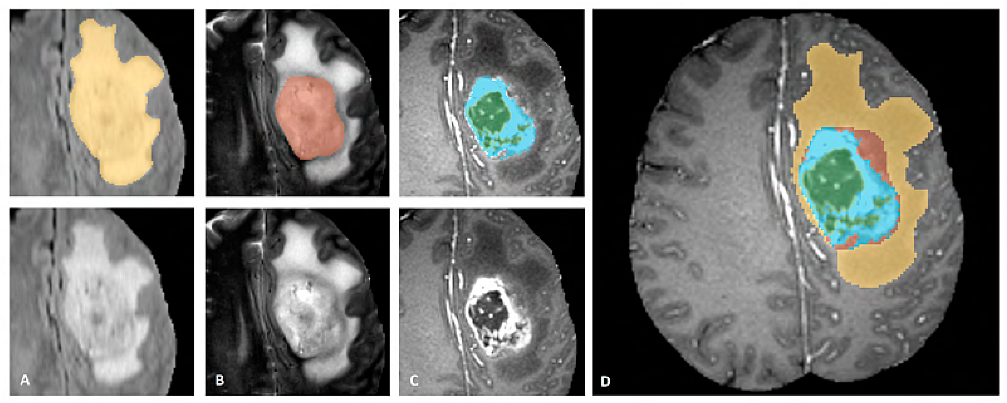 DeepTumor: Framework for Brain MR Image Classification, Segmentation and Tumor Detection
