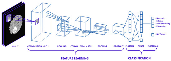 DeepTumor: Framework for Brain MR Image Classification, Segmentation and Tumor Detection