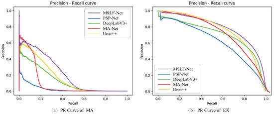 MSLF-Net: A Multi-Scale and Multi-Level Feature Fusion Net for Diabetic ...