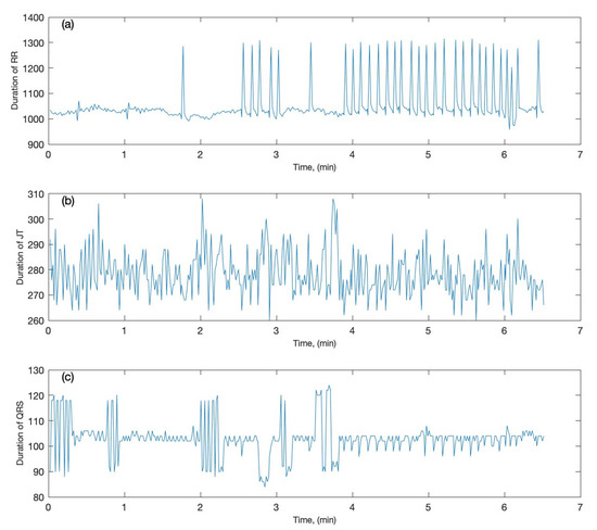 Detection of Atrial Fibrillation Episodes based on 3D Algebraic ...