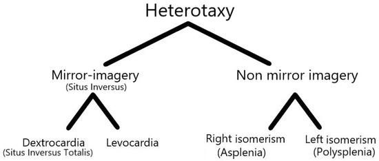 Splenic Torsion in Heterotaxy Syndrome with Left Isomerism: A Case ...