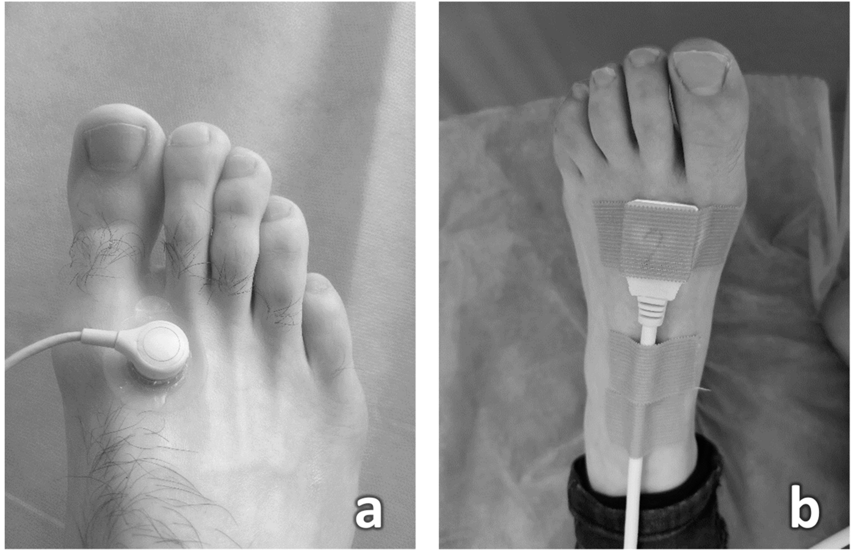 Incoherent Optical Fluctuation Flowmetry: A New Method for the ...