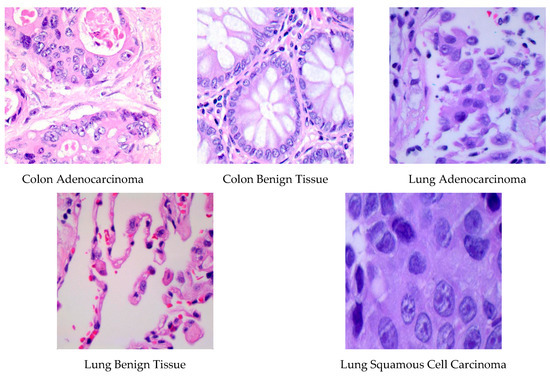 Diagnostics | Free Full-Text | A Framework for Lung and Colon Cancer ...