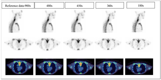 Diagnostics | Free Full-Text | Transition to Fast Whole-Body SPECT/CT ...