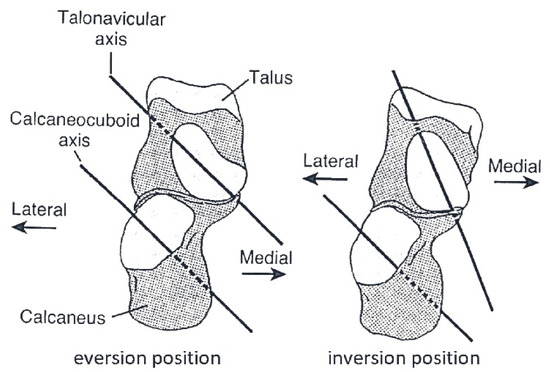 Muscular Systems and Their Influence on Foot Arches and Toes Alignment ...