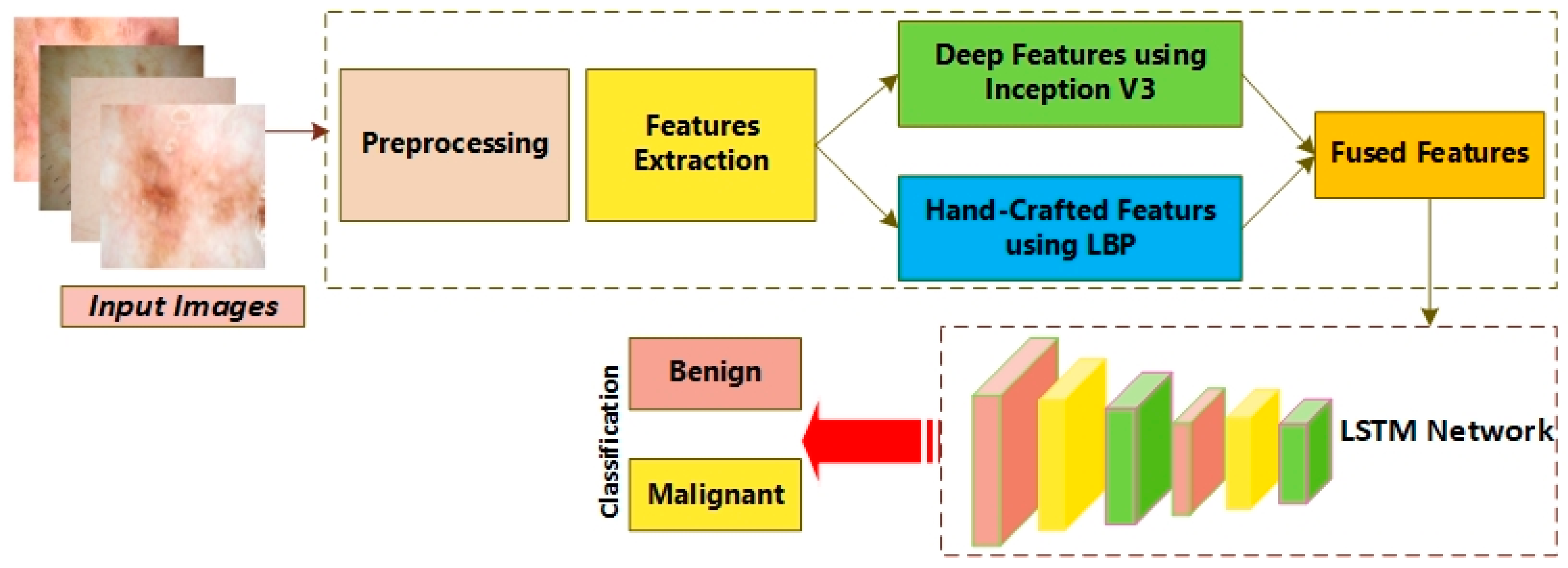 Diagnostics | Free Full-Text | Skin Lesion Detection Using Hand-Crafted and DL-Based Features ...