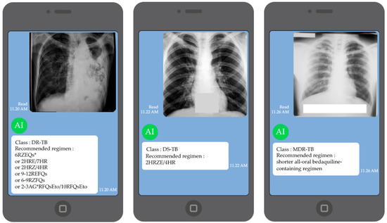 Diagnostics | Free Full-Text | Embedded AMIS-Deep Learning with Dialog-Based Object Query System ...