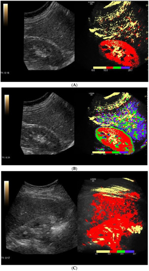 Contrast-Enhanced Ultrasonography with Arrival Time Parametric Imaging ...