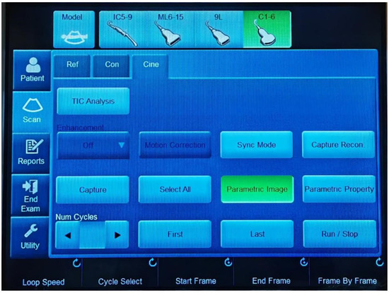 Contrast-Enhanced Ultrasonography with Arrival Time Parametric Imaging ...