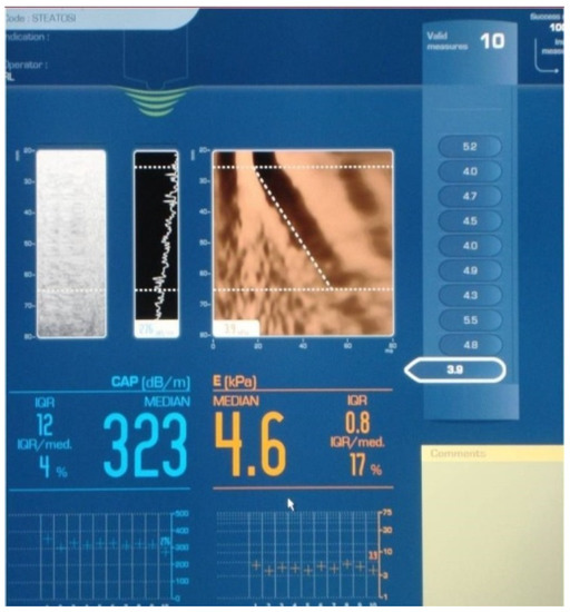 Contrast-Enhanced Ultrasonography with Arrival Time Parametric Imaging ...