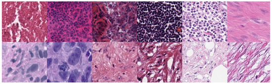 Diagnostics | Free Full-Text | Efficient Staining-Invariant Nuclei Segmentation Approach Using ...
