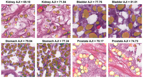 Diagnostics | Free Full-Text | Efficient Staining-Invariant Nuclei Segmentation Approach Using ...