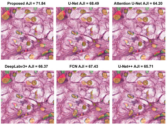 Diagnostics | Free Full-Text | Efficient Staining-Invariant Nuclei Segmentation Approach Using ...