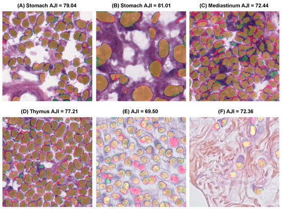 Diagnostics | Free Full-Text | Efficient Staining-Invariant Nuclei Segmentation Approach Using ...