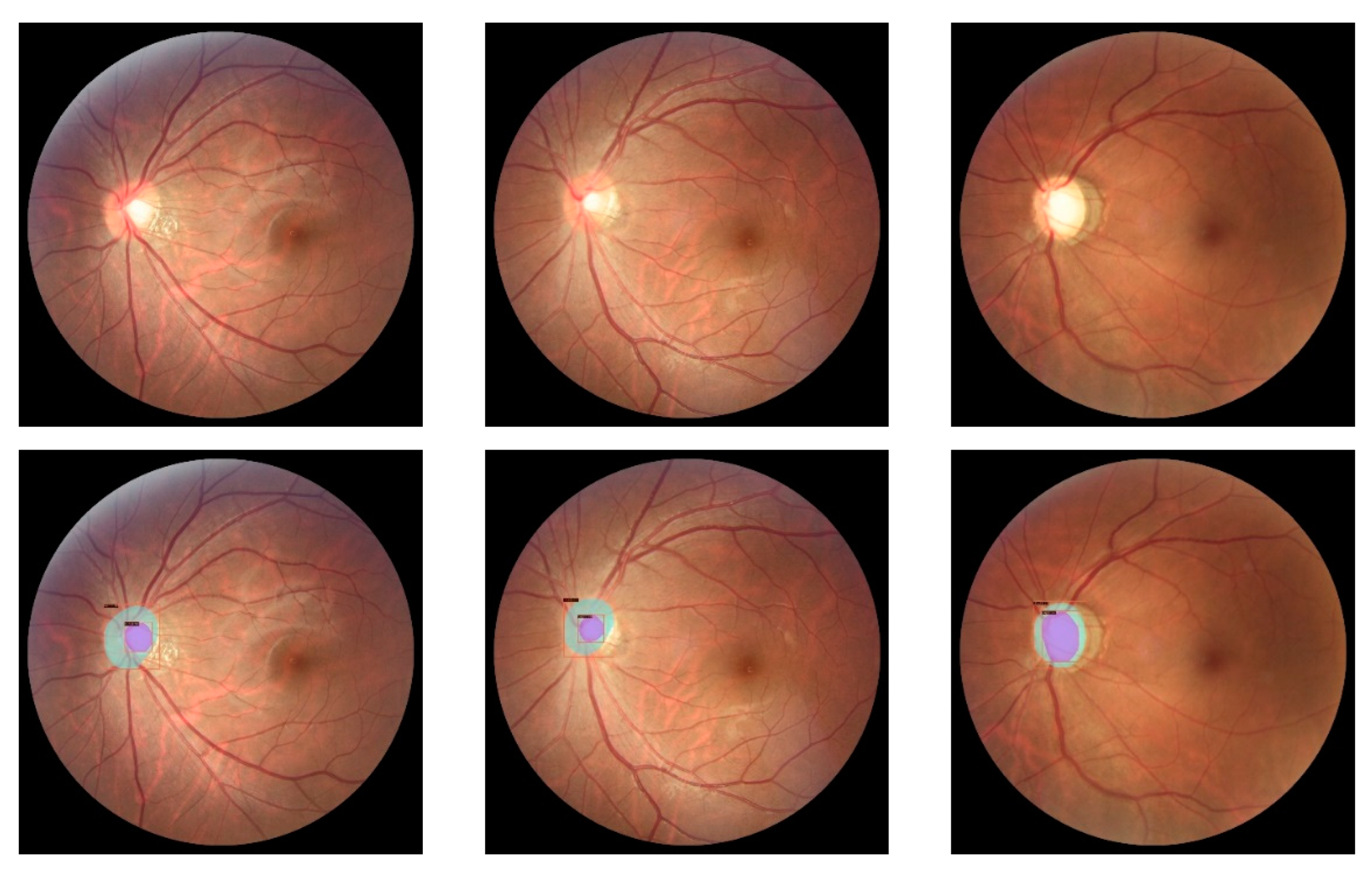 Performance Evaluation of Different Object Detection Models for the Segmentation of Optical Cups ...