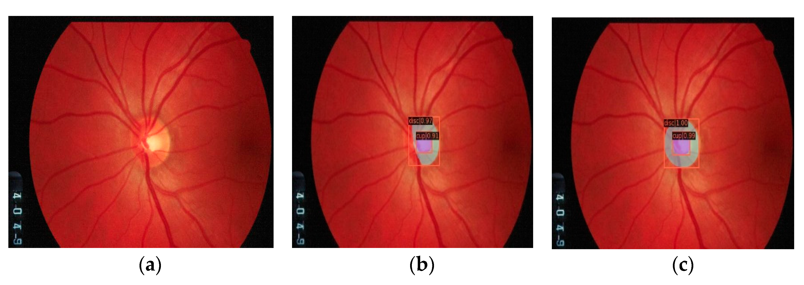 Performance Evaluation of Different Object Detection Models for the Segmentation of Optical Cups ...