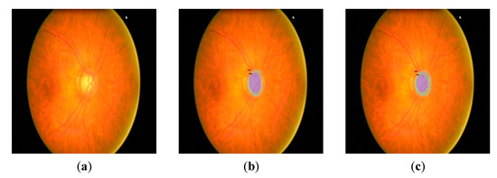 Performance Evaluation of Different Object Detection Models for the Segmentation of Optical Cups ...