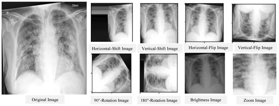A Survey on AI Techniques for Thoracic Diseases Diagnosis Using Medical ...