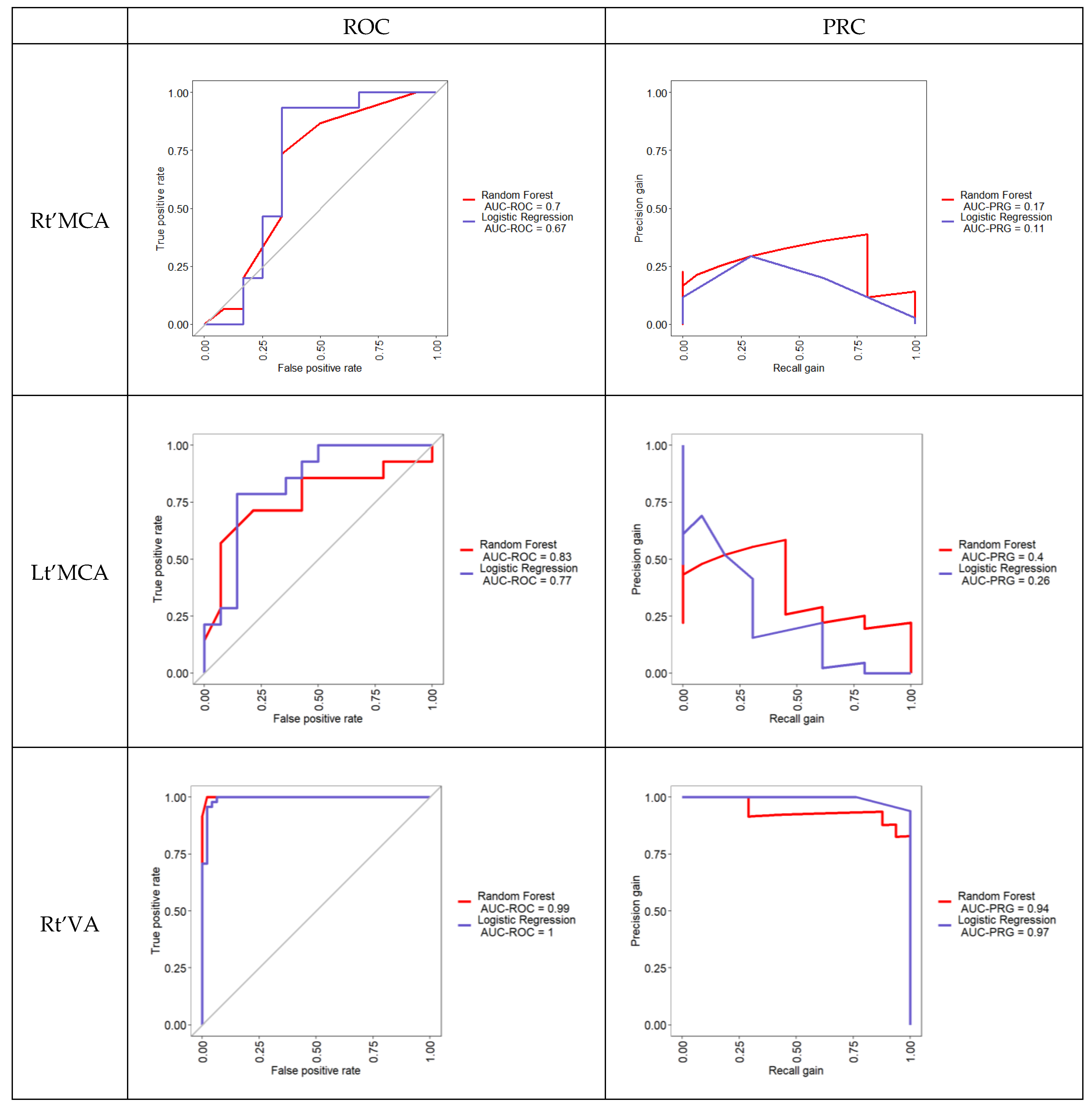 Development and Validation of Machine Learning Models to Classify Artery Stenosis for Automated ...
