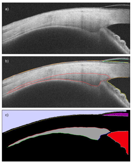 Performance of the Deep Neural Network Ciloctunet, Integrated with Open-Source Software for ...