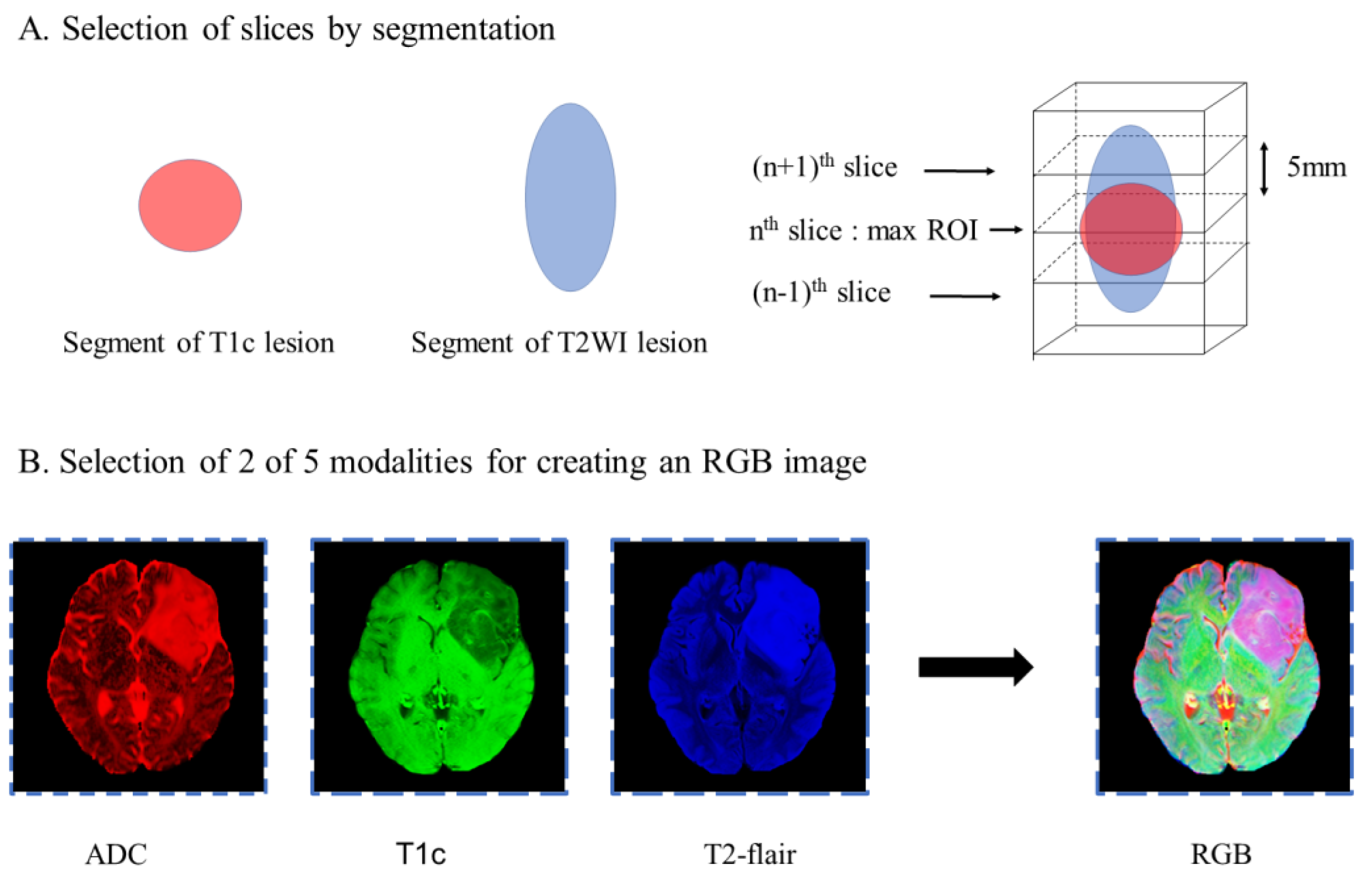 Noninvasive Classification of Glioma Subtypes Using Multiparametric MRI to Improve Deep Learning