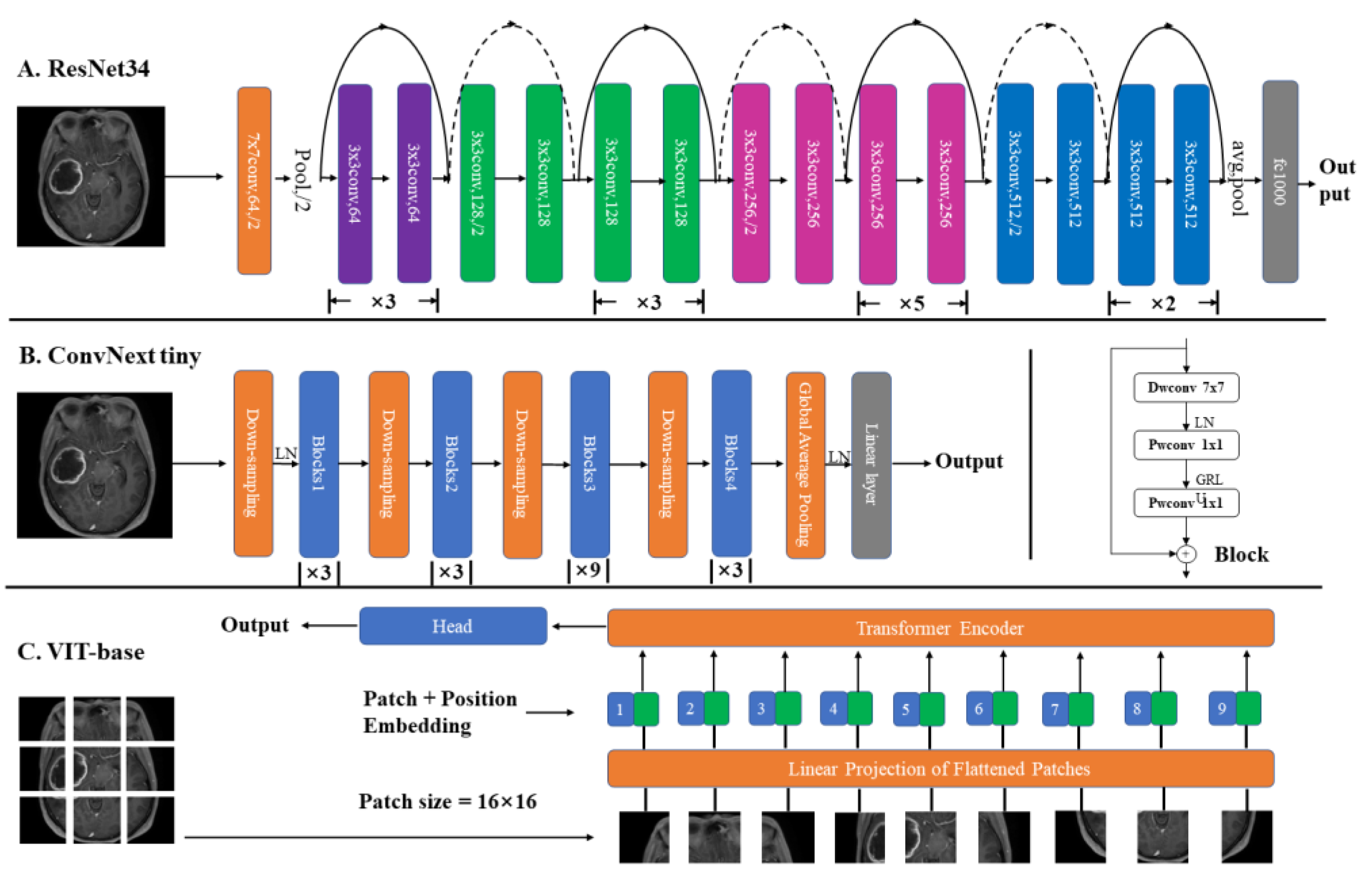 Noninvasive Classification of Glioma Subtypes Using Multiparametric MRI to Improve Deep Learning