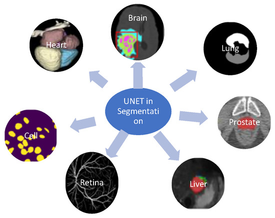 Review of Semantic Segmentation of Medical Images Using Modified ...