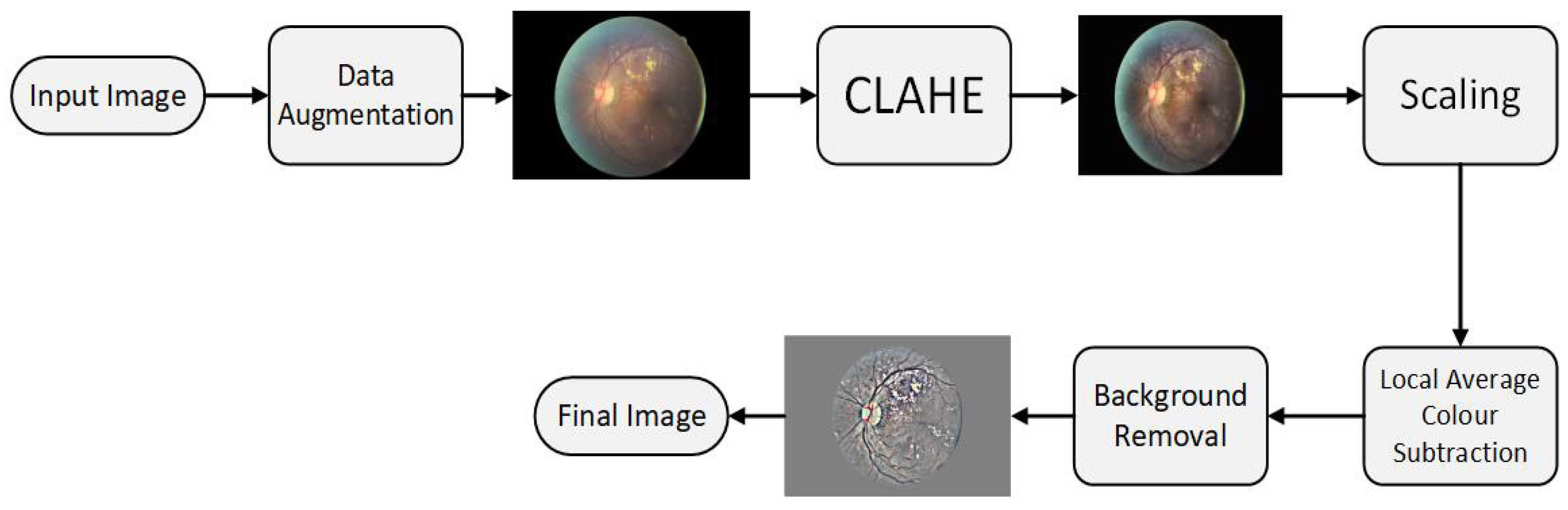 A Deep Learning Based Approach for Grading of Diabetic Retinopathy ...