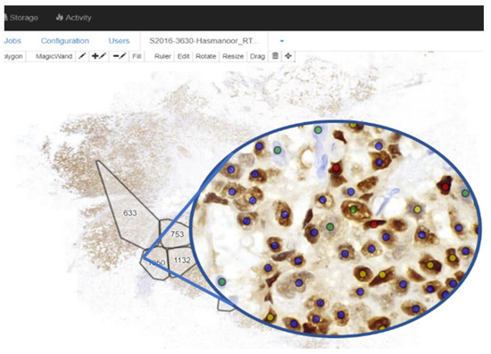 Allred Scoring of ER-IHC Stained Whole-Slide Images for Hormone ...