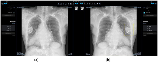 Inter- and Intra-Observer Agreement When Using a Diagnostic Labeling ...