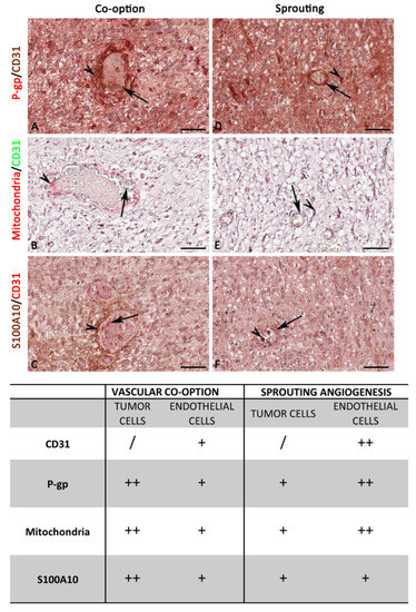 Differential P-Glycoprotein/CD31 Expression as Markers of Vascular Co ...