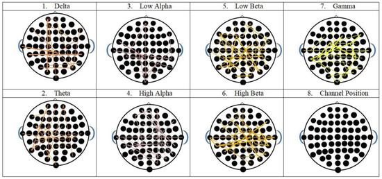 Identifying Complex Emotions in Alexithymia Affected Adolescents Using ...