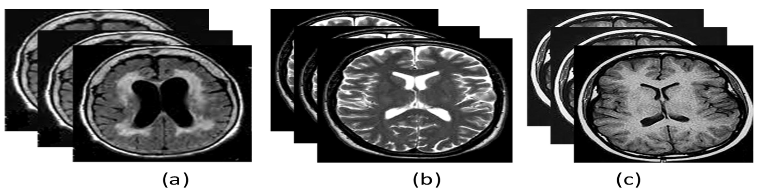 Diagnostics | Free Full-Text | Ensemble Model for Diagnostic Classification of Alzheimer’s ...