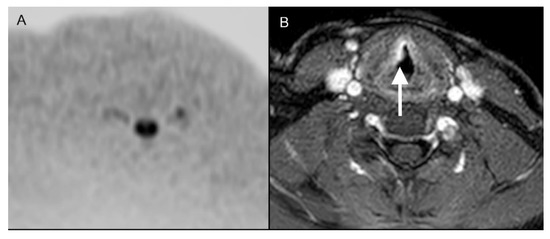 Additional Diffusion-Weighted Imaging with Background Body Signal ...