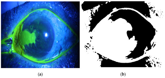 Automated Detection of Corneal Ulcer Using Combination Image Processing and Deep Learning