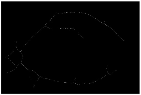 Automated Detection of Corneal Ulcer Using Combination Image Processing ...