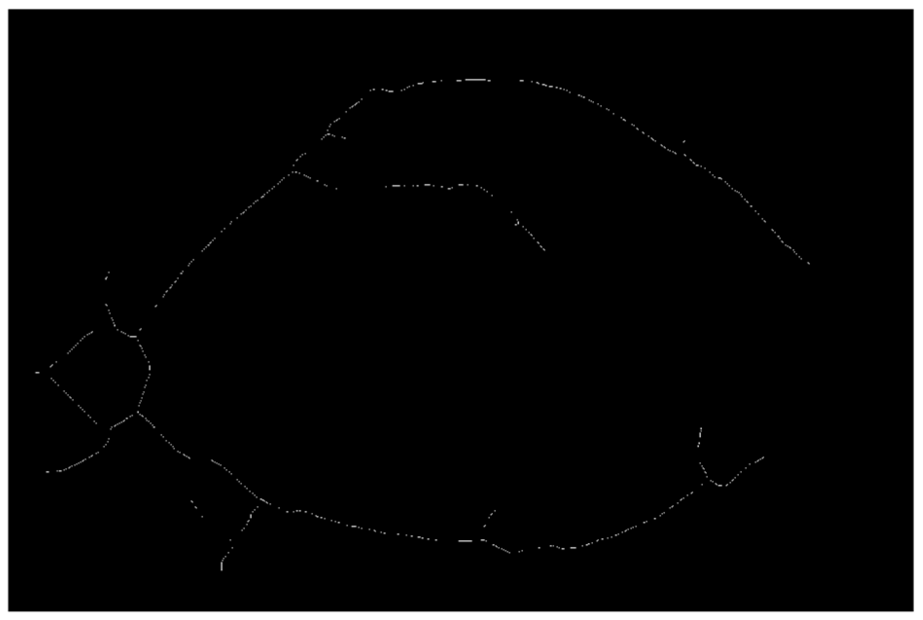 Automated Detection of Corneal Ulcer Using Combination Image Processing and Deep Learning