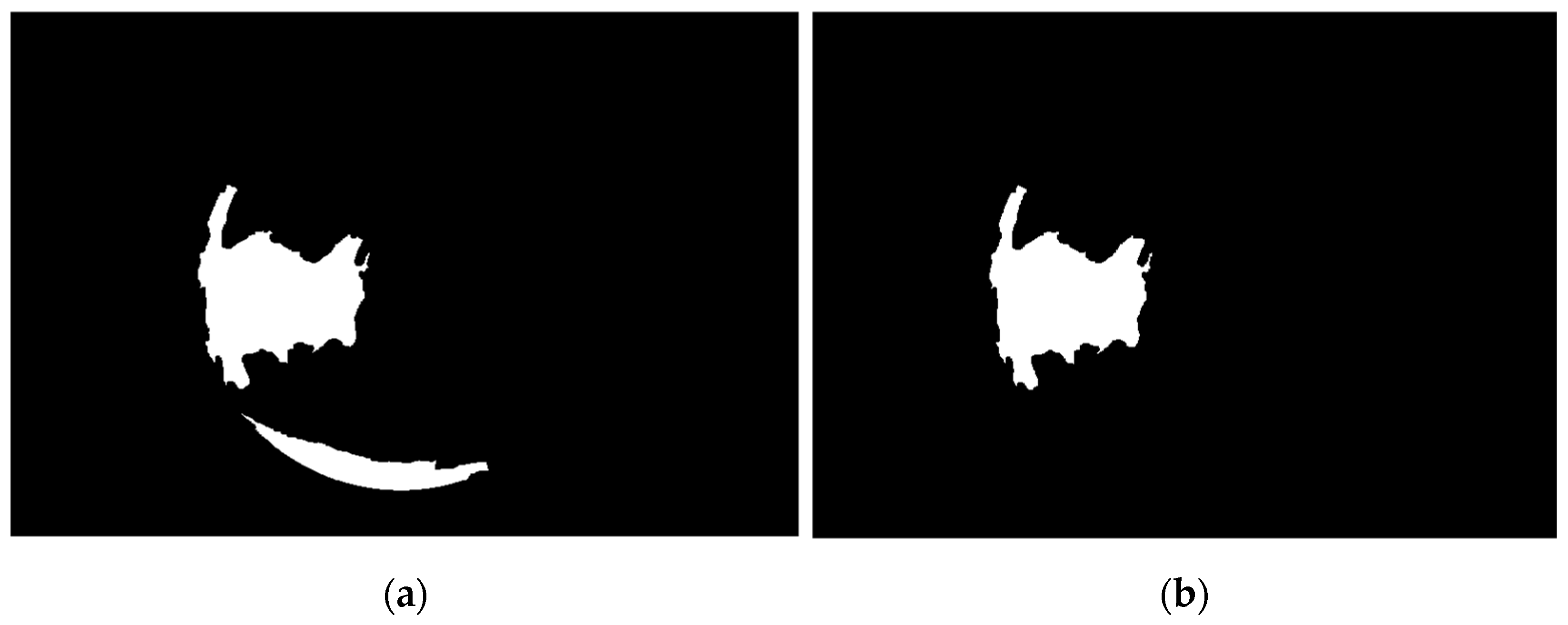 Automated Detection of Corneal Ulcer Using Combination Image Processing and Deep Learning