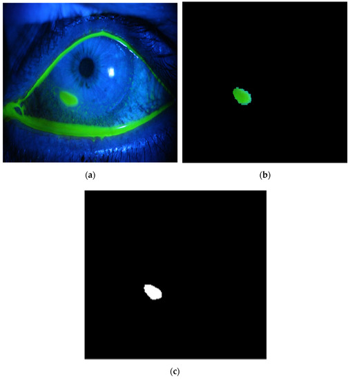 Automated Detection of Corneal Ulcer Using Combination Image Processing and Deep Learning